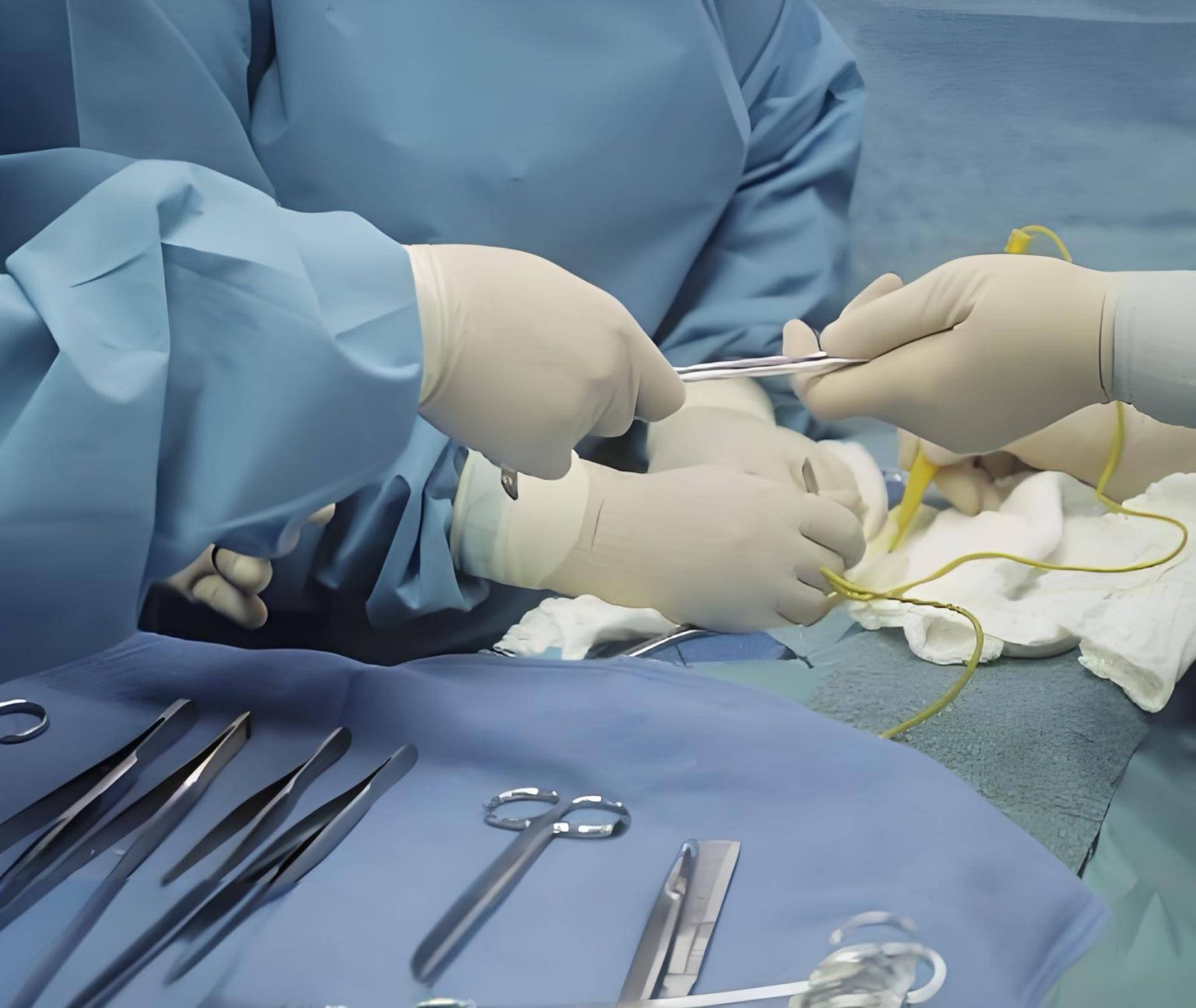 Pain-Free Circumcision: A Complete Patient Guide – Preparation, Procedure, and Recovery